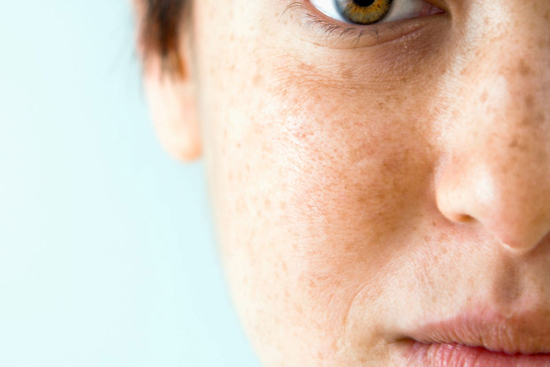 Patient Information | Dr Carol Adib | Brisbane Dermatologist